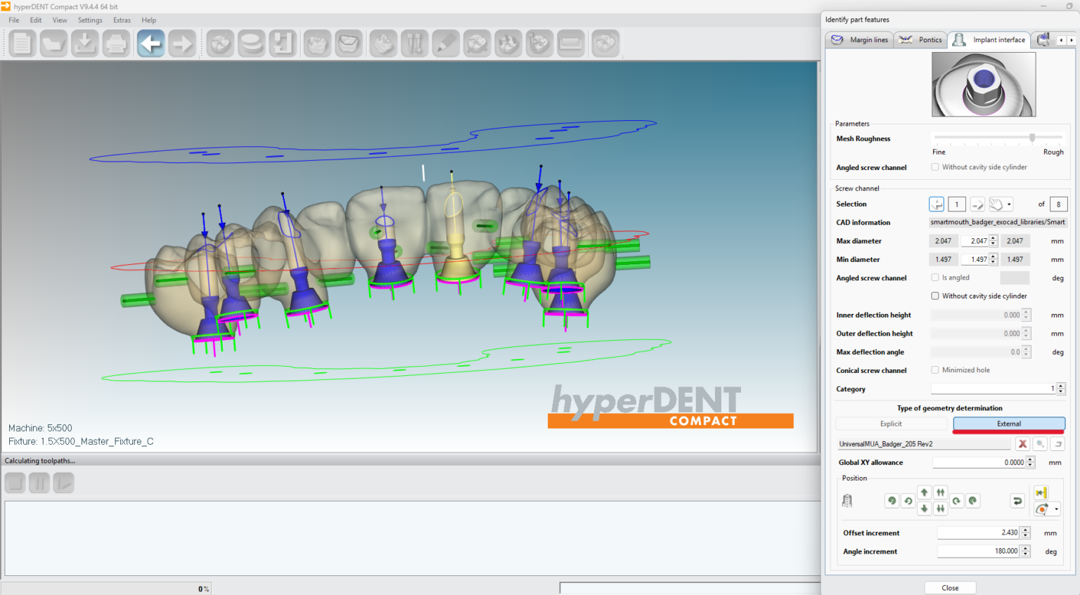 Hyperdent Library - Smart Mouth Technologies